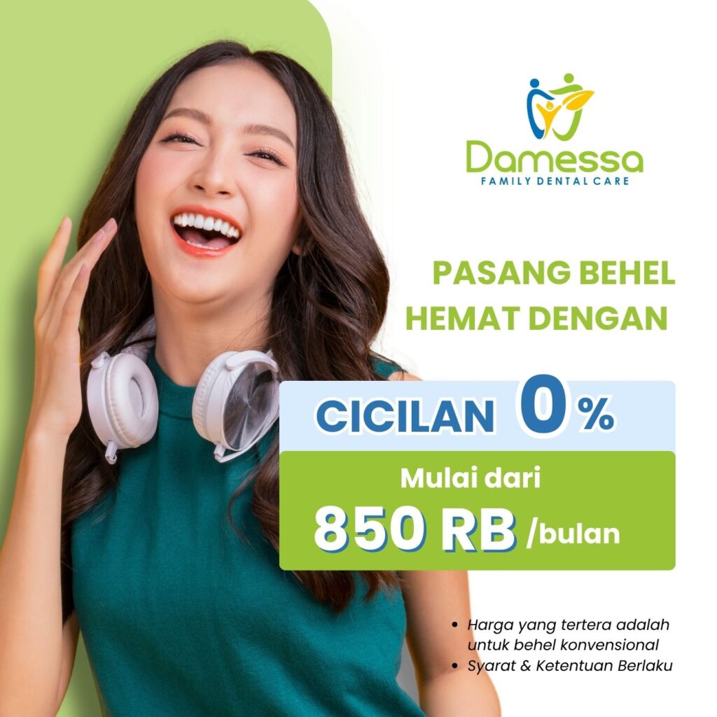 Pasang Behel Gigi dan Aligner Gigi di Damessa Dental Care