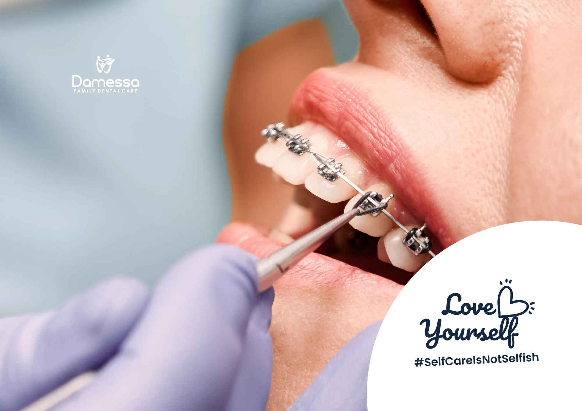 6 Alasan Mengapa Perlu Pasang Behel ke Orthodontist