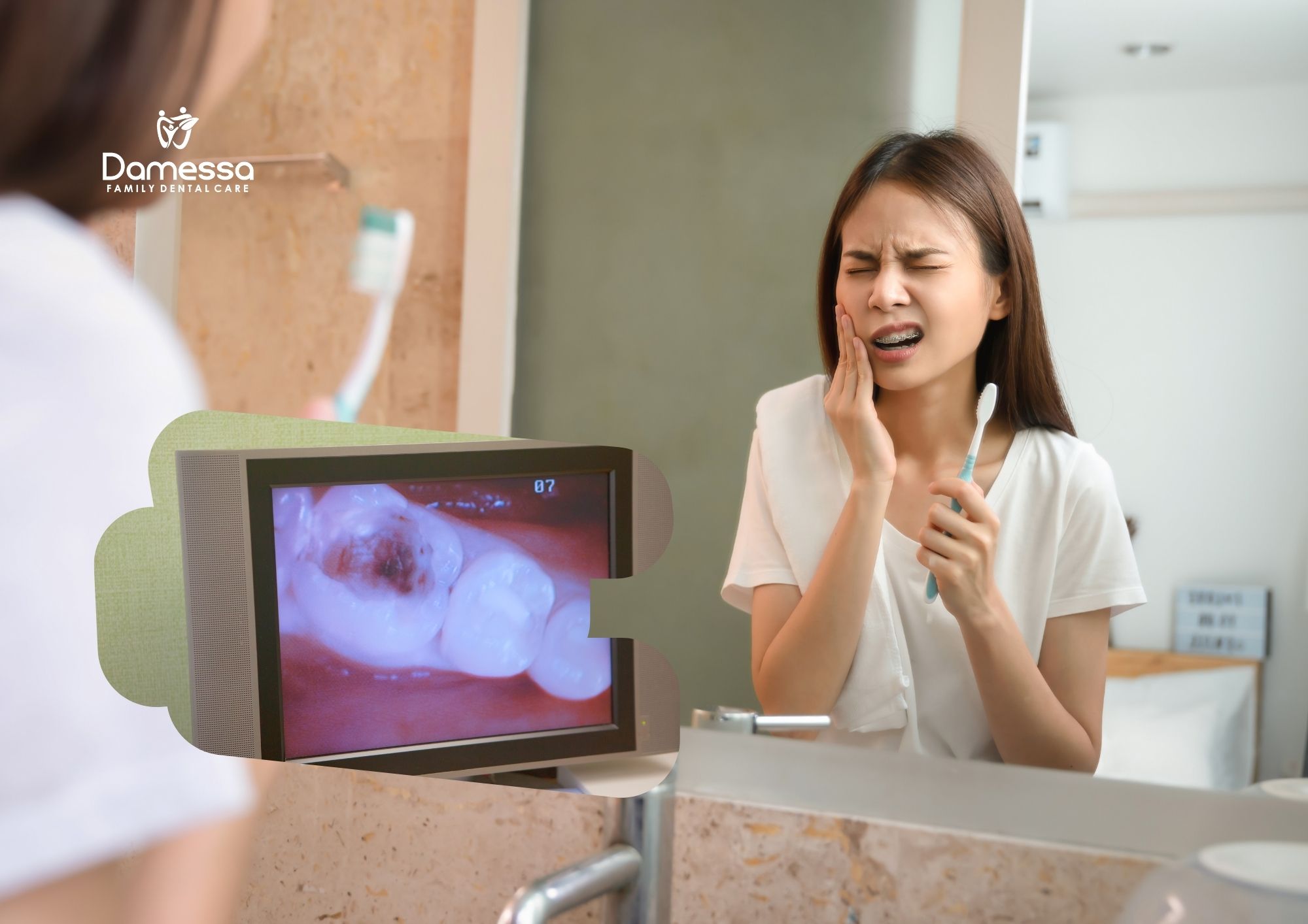 Cara Menghilangkan Ngilu pada Gigi Berlubang dengan Tepat - Damessa