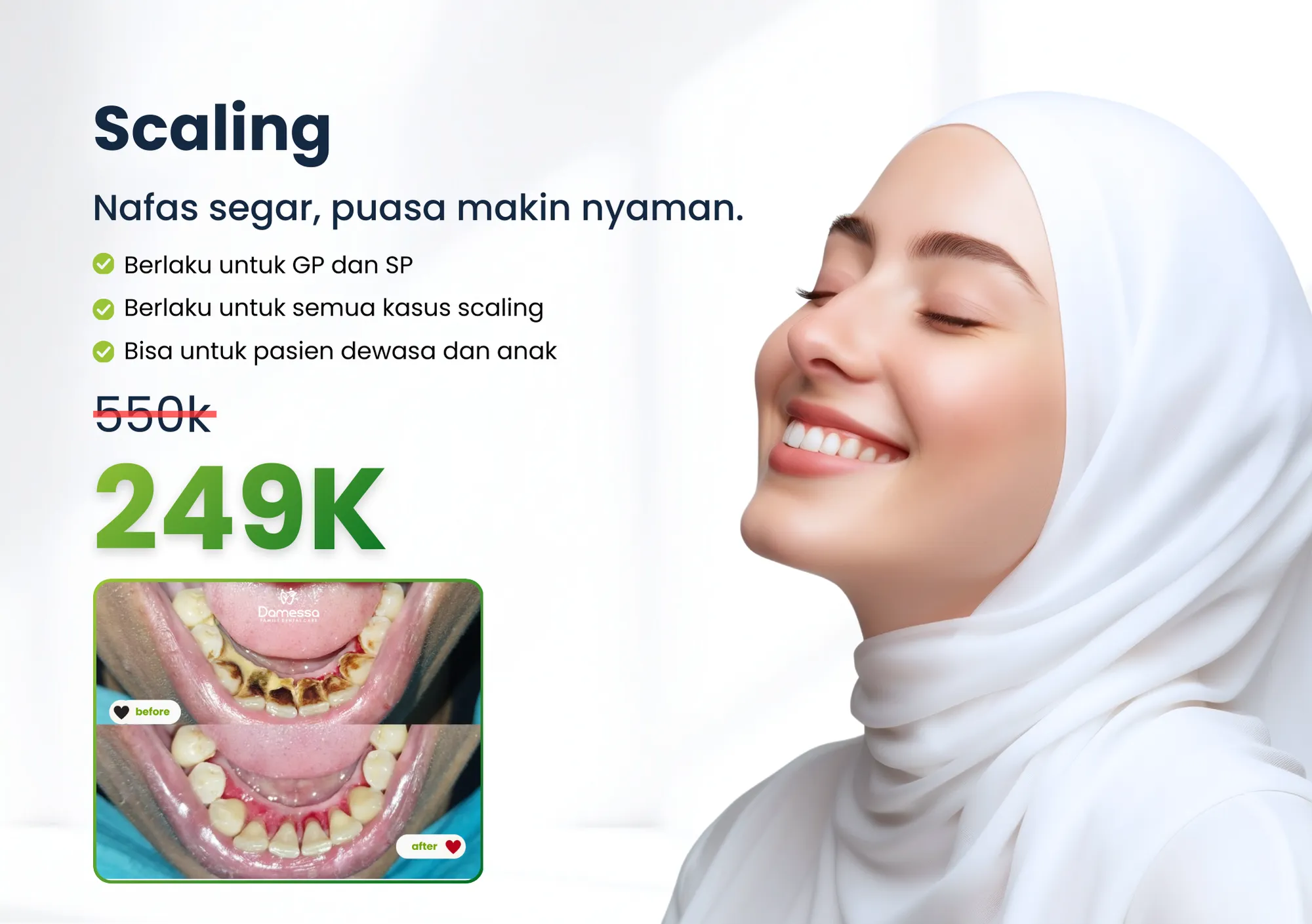 Kisaran Biaya Pasang Behel di Dokter Gigi Spesialis Ortodonti